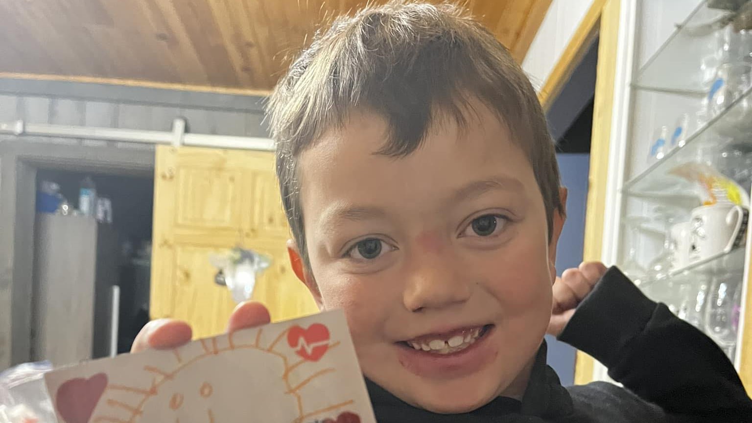 Brayden Parker, Enfant Soleil pour une deuxième année | CHGA