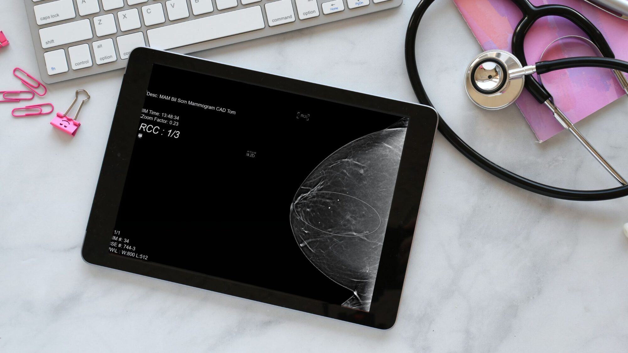 L’unité mobile de mammographie CLARA à Maniwaki pour 20 jours dès le 8 ...